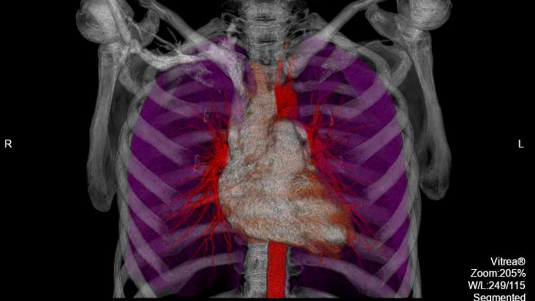 Division of Cardiothoracic Imaging | Columbia Radiology | Columbia ...