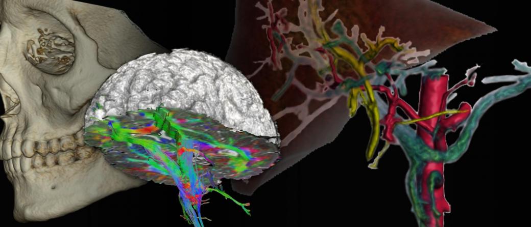 3D Lab - Radiology Image Processing | Columbia Radiology | Columbia ...