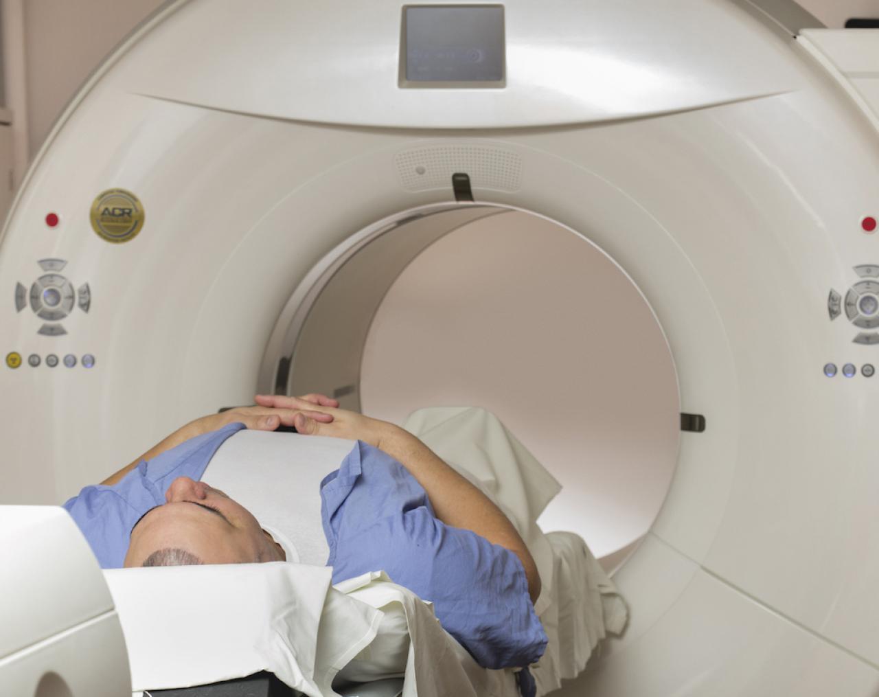 Lung Cancer Screening Saves Lives, So Why Don’t All Eligible Smokers ...