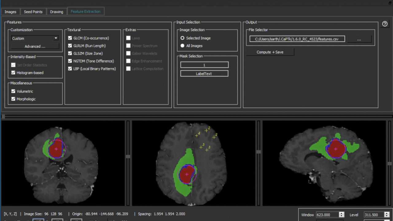 Computational Biomarker Imaging Group (CBIG) | Columbia Department of Radiology