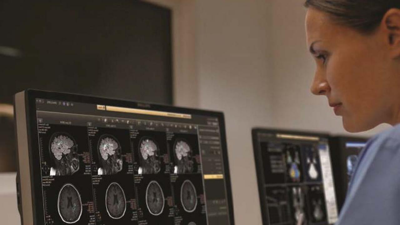 New Picture Archiving System (PACS) | Columbia Department of Radiology