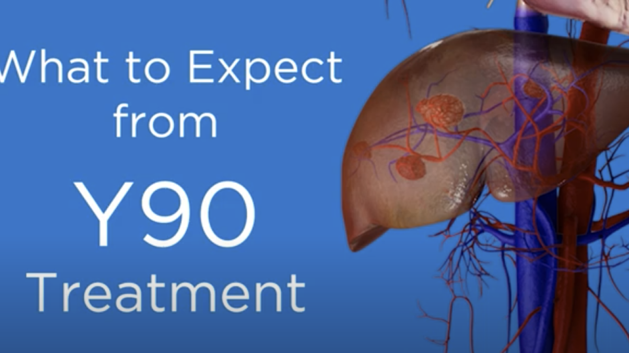 Video: Y90 Treatment for Cancer in the Liver | Columbia Department of ...