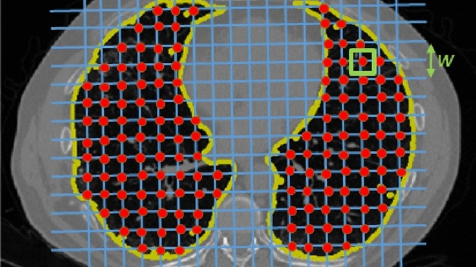 Computational Biomarker Imaging Group (CBIG) | Columbia Department of ...