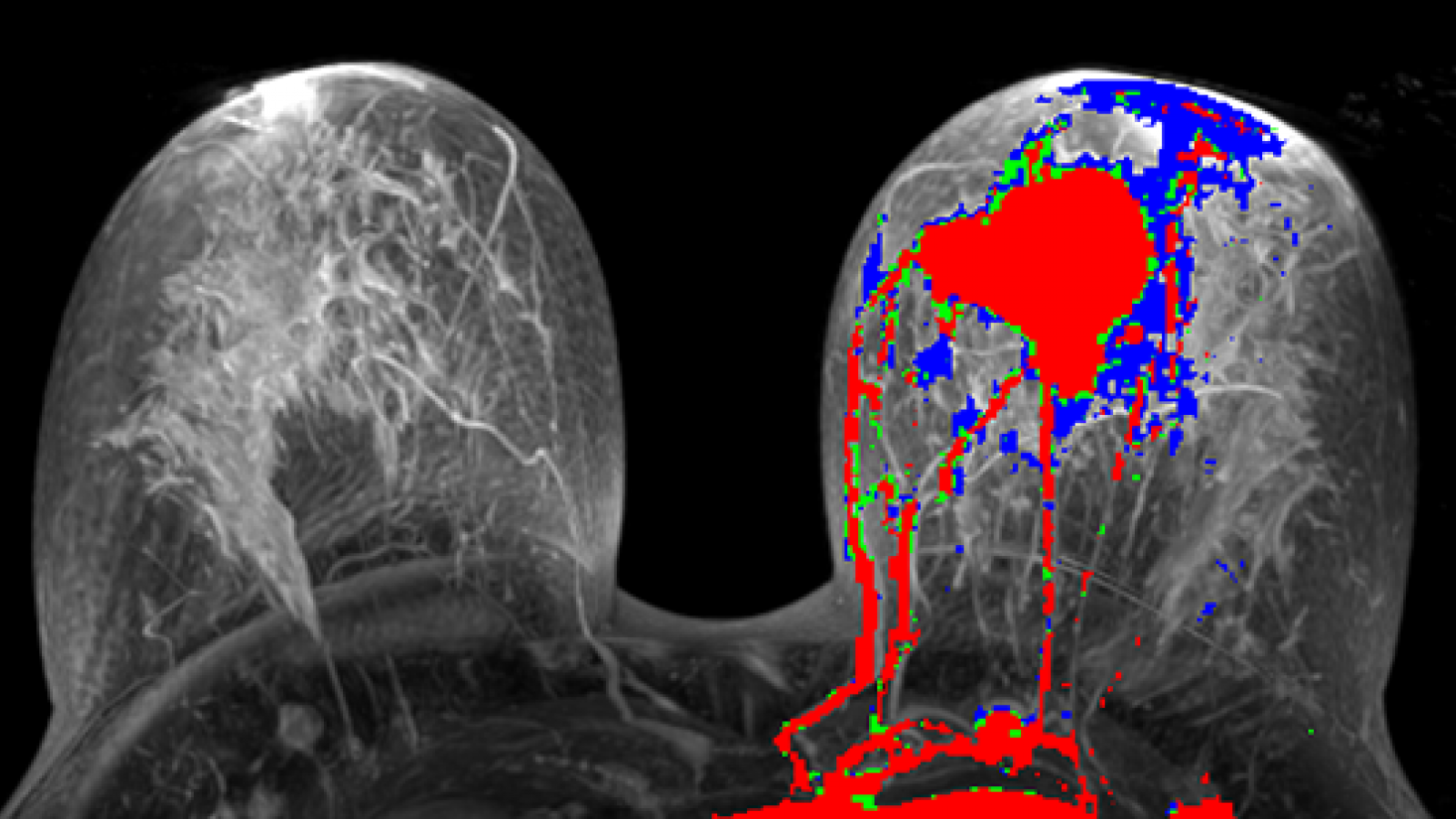 Division of Breast Imaging | Columbia Radiology | Columbia Department ...