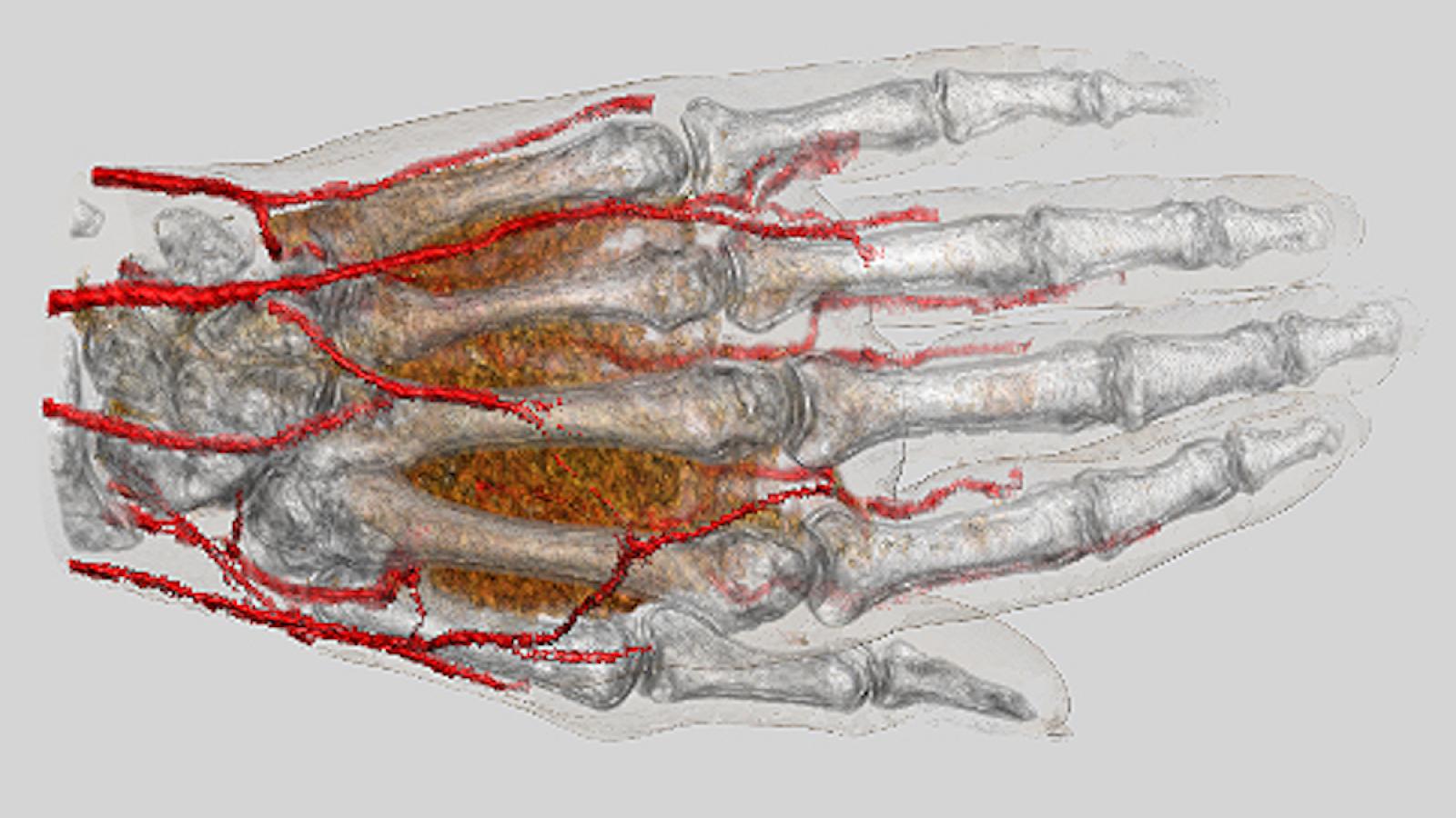 About the 3D Lab | Columbia Radiology | Columbia Department of Radiology