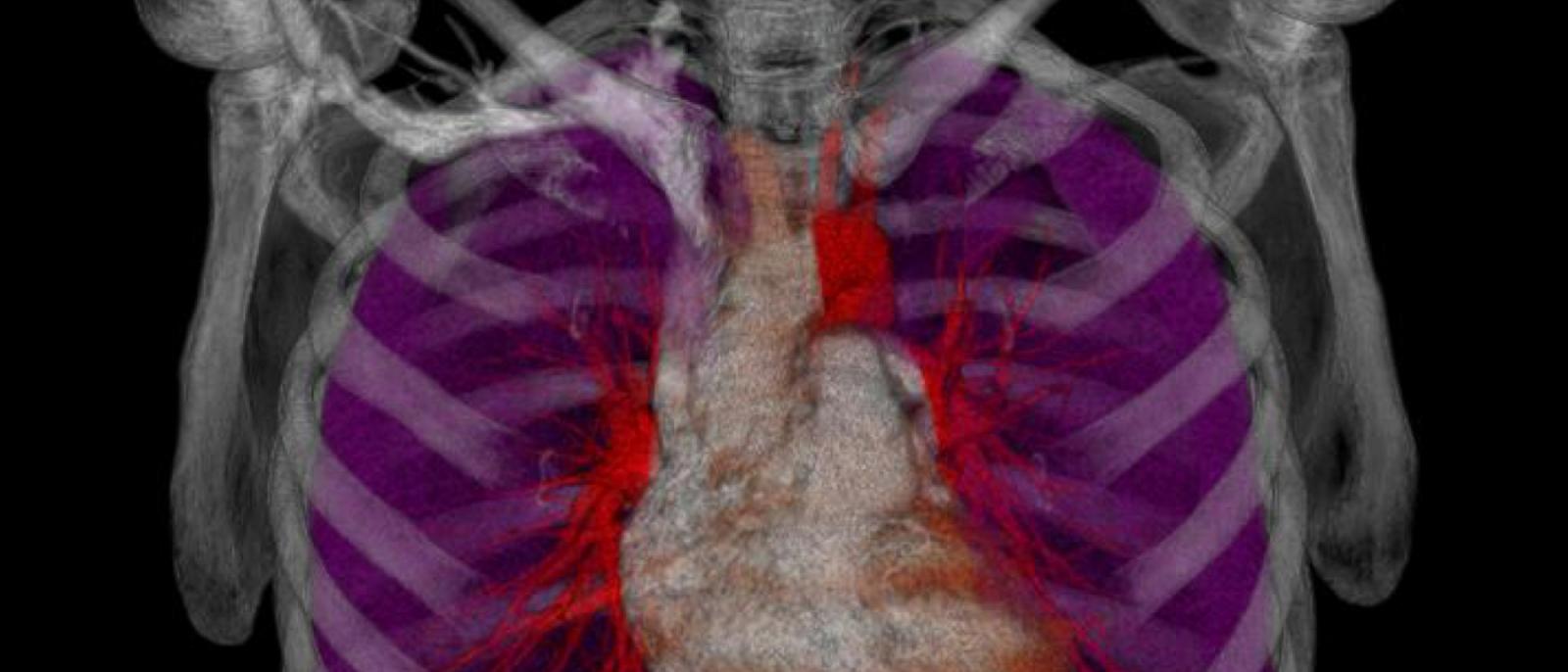 3D Radiology Services in NYC | | Columbia Radiology | Columbia ...