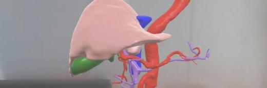 3D Lab - Radiology Image Processing | Columbia Radiology | Columbia ...