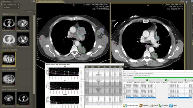 Computational Image Analysis Lab Services Columbia Radiology Columbia Department Of Radiology